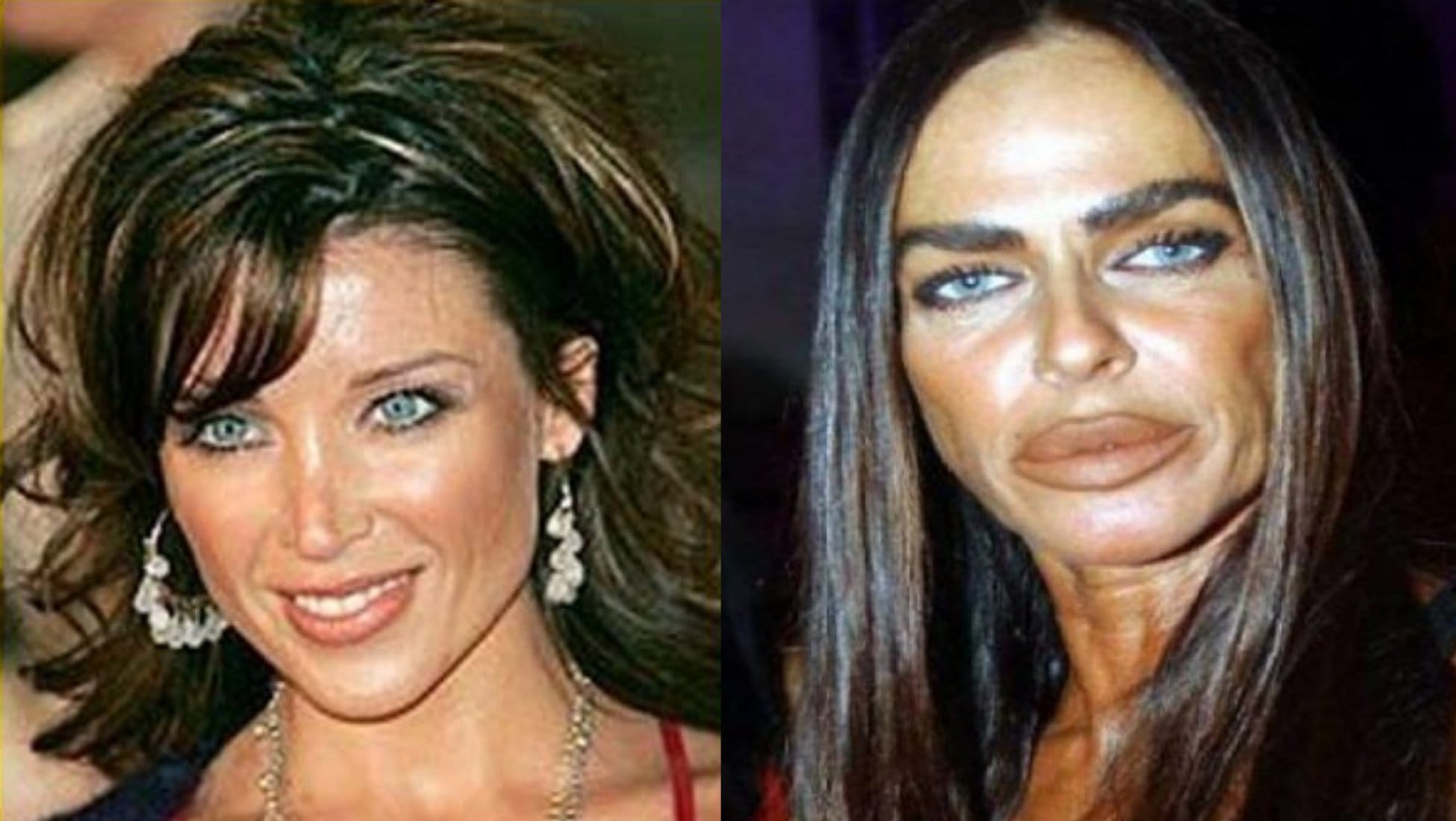 TOP 10 Famosas Operadas 【 Ranking de Malas Cirugías